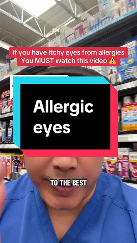 Replying To Monika If You Have Itchy Red Watery Eyes From Allergies