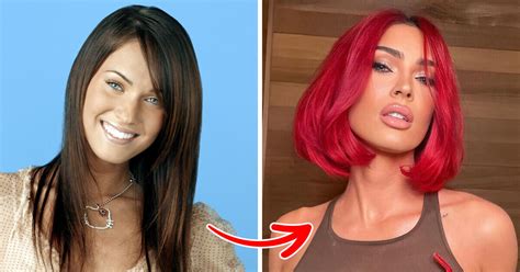 Megan Fox Candidly Reveals Every Single Plastic Surgery Shes Had Done
