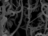 Scanning Electron Microscope Of Spores Of Streptomyces Avermitilis Sp