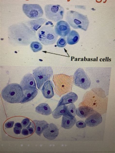 Parabasal Cells