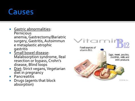 Pernicious Anemia Vitamin B12 Deficiency