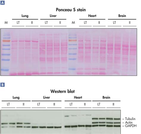 Tissuelyser Ltqiagen优宁维univ商城