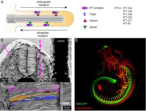 Figure 1 From Mutations In Ciliary Trafficking Genes Affect Sonic
