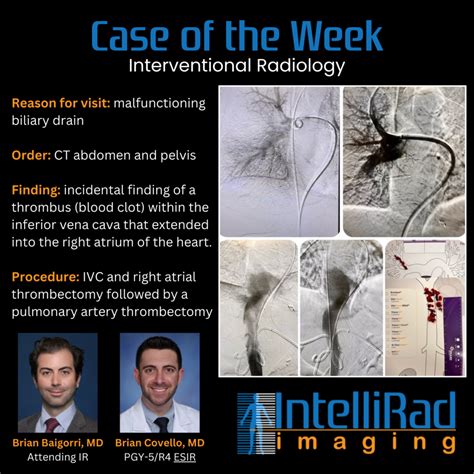 Case Of The Week Malfunctioning Biliary Drain Intellirad Imaging
