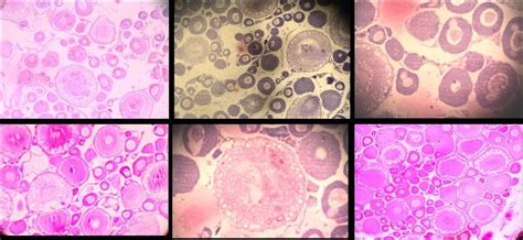 Photomicrographs 50 X Of Ts Of Ovary Of Schizothorax Niger Heckel