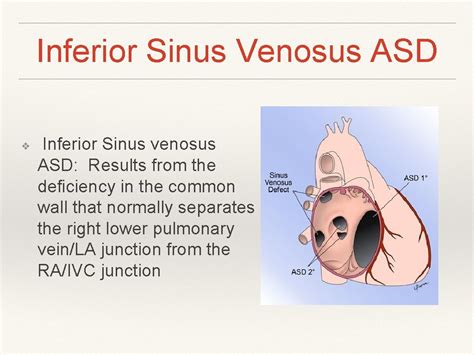 Ucsf Congenital Cardiac Anesthesia Tutorials Vsds And Asds