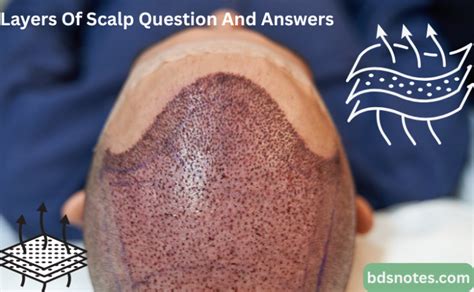 Layers Of Scalp Question And Answers Bds Notes