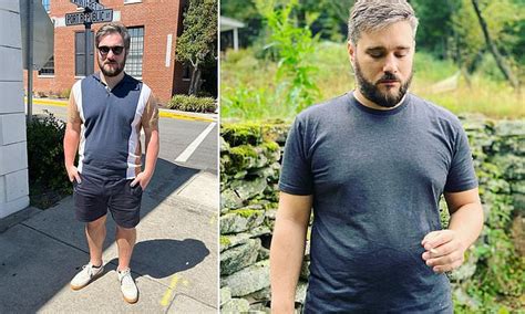 Man 34 Who Suffers From A Condition That Makes Him Grow Breasts