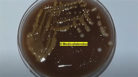 Cryptococcus Introduction Morphology Pathogenicity Lab Diag