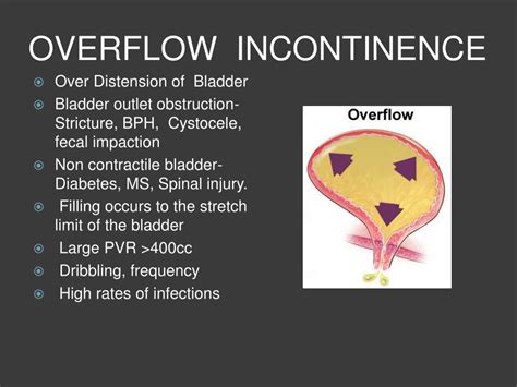 Overflow Incontinence Rekaconsultant