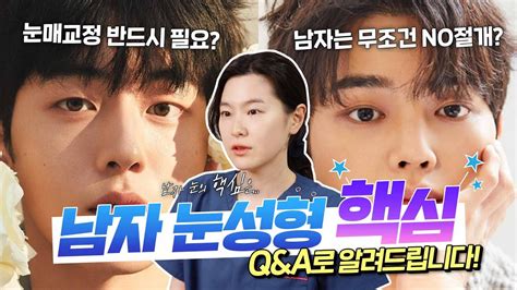 송강의 눈이 갖고 싶어 남자 눈성형의 모든 것 Youtube