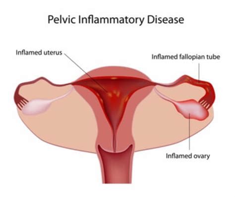 Fallopian Tube The Definitive Guide Biology Dictionary