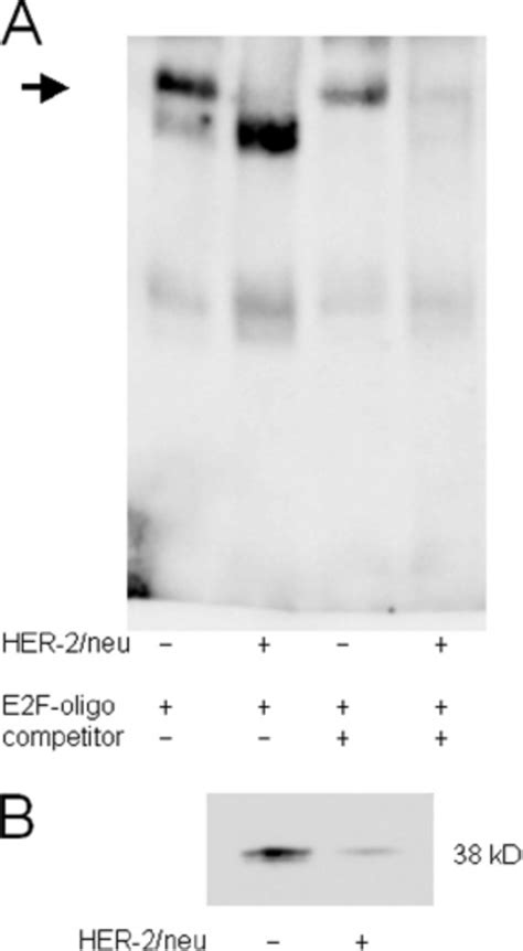 Different Binding Properties For Distal E2f Motif In The Tapasin Download Scientific Diagram