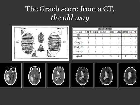Measure Ivh Graeb Scale Quantitative Analysis Of Blood