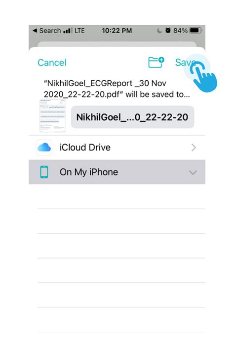 How To Export Your Ecg From Fitbit Qaly
