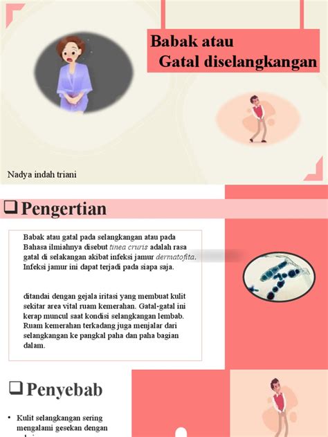 Tinea Cruris Ppt Nadya Pdf