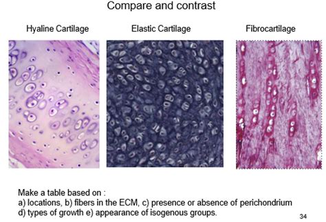 Hyaline Cartilage Vs Elastic Cartilage