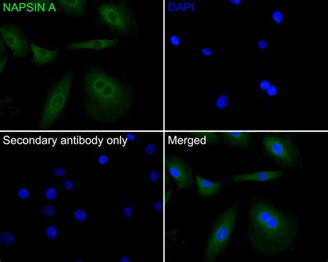 Napsin A Mouse Monoclonal Antibody A9c4 Ha601097 Huabio