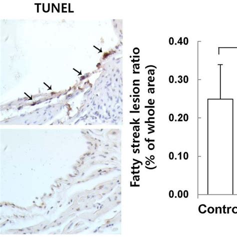 Oil Red O And Tunel Staining Of The Aortic Sinus Of Ldl Receptor