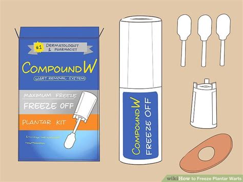 How To Freeze Plantar Warts Wikihow