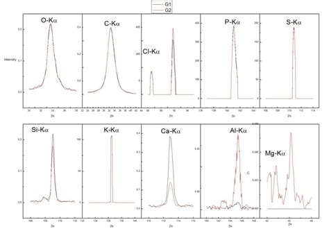 Element Analysis Results Of Brain Sample Obtained By Wdxrf Spectrometer