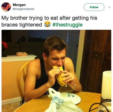 Hilarious Braces Memes That Will Make You Smile