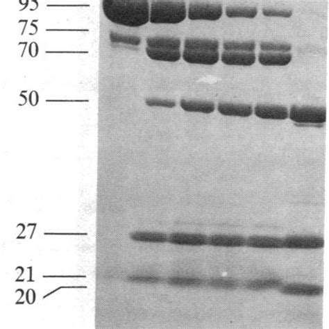 Time Course Of Limited Cleavage Of S 1 By Plasmin T Trypsin Split S 1 Download Scientific