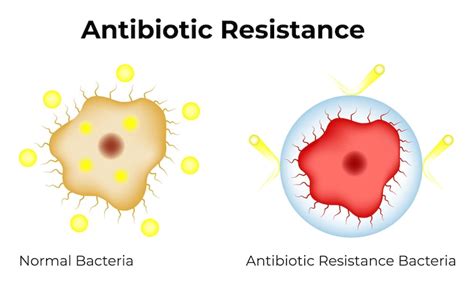 Antibiotic Resistance Normal Bacteria Antibiotic Resistance Bacteria