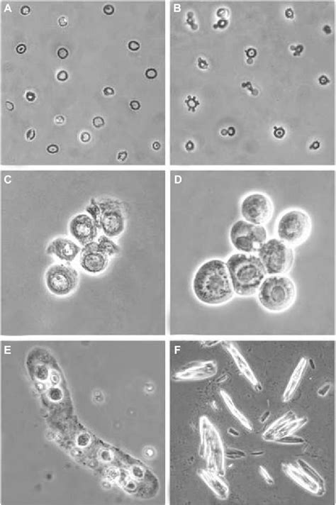Transitional Renal Epithelial Cells In Urine