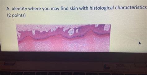 Solved Describe The Features That Prevents Separation Of The