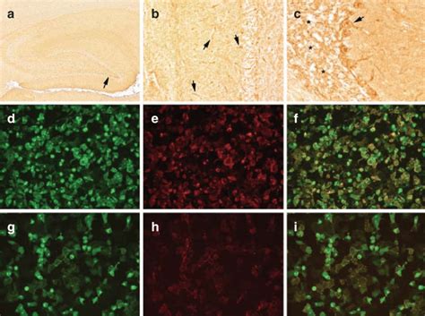 3 Staining Pattern Of Aqp4 Antibodies On A Tissue Based Assay Optimized Download Scientific