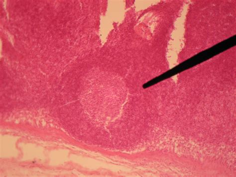 Lymphnode Of Beef 8 Doccheck