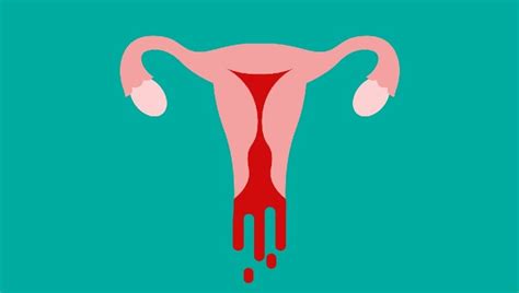 Vaginal Bleeding After Sex Know The Causes Of Postcoital Bleeding Healthshots