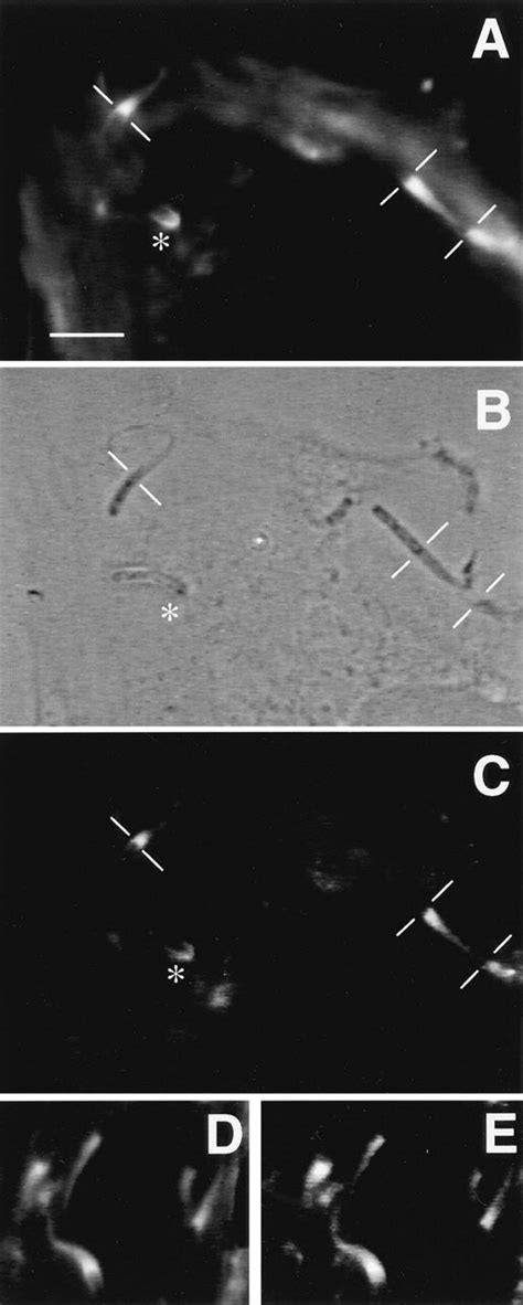 Immunofluorescence Microscopy Of Shigella Infected Ptk2 Cells Using