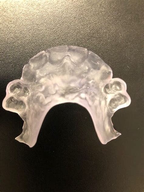 Orthodontic News Urbanek Tmj Device Announces Launch Of Commercial