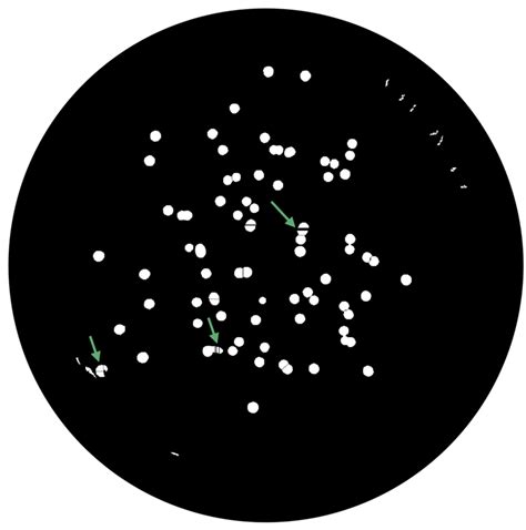 Segmentation Through Watershed Ridges Download Scientific Diagram