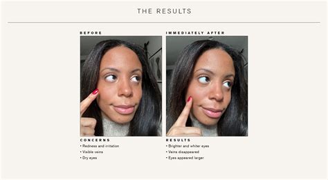 An Honest Review Of Lumify Redness Reliever Eye Drops Who What Wear