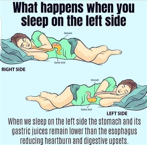 Hiatal Hernia Symptoms Causes Natural Support Strategies Artofit