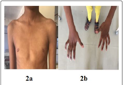 The Figure 2a Indicates Widely Spaced Nipples And Figure 2b