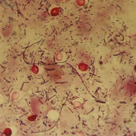 Cryptosporidium Parvum Oocysts With Modified Acid Fast Staining