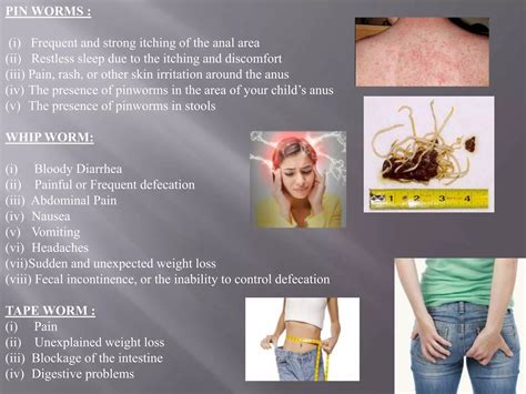 Worm Infestation Pptx