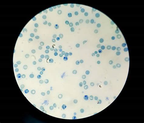 What Is Retic In Dog Blood Test