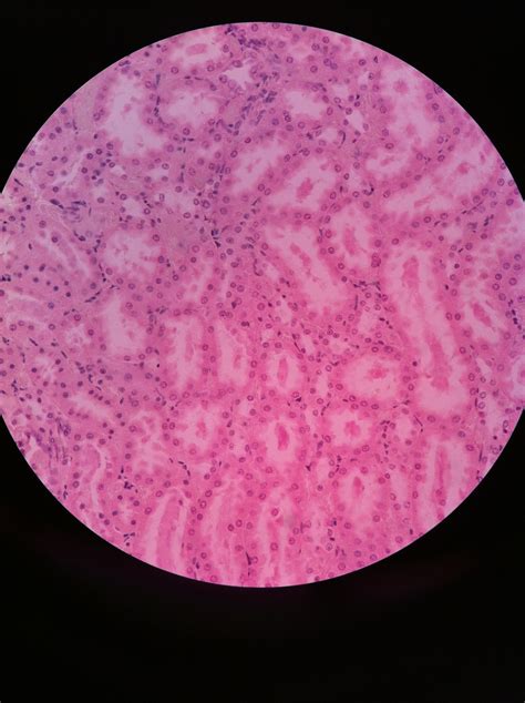 Simple Cuboidal Epithelium Slide 400x