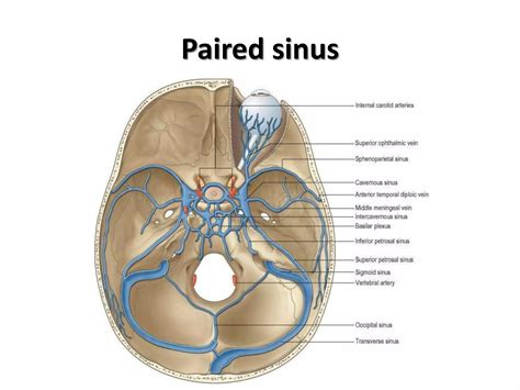 Dural Venous Sinuses Pdf