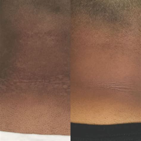 Image Gallery Derma Revive Skin Clinic