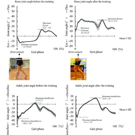 Knee And Ankle Joints Angle On The Affected Side During Gait Before And