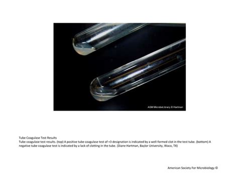 Coagulase Testpptx Blood Disorders Diseases And Conditions