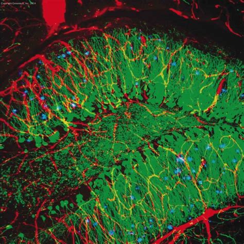 Computational Modeling In Neuroscience Paris Brain Institute