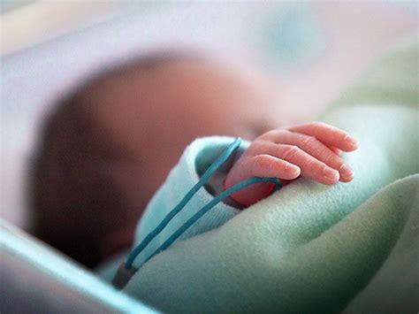 Floating Harbor Syndrome Symptoms Cause And Treatment