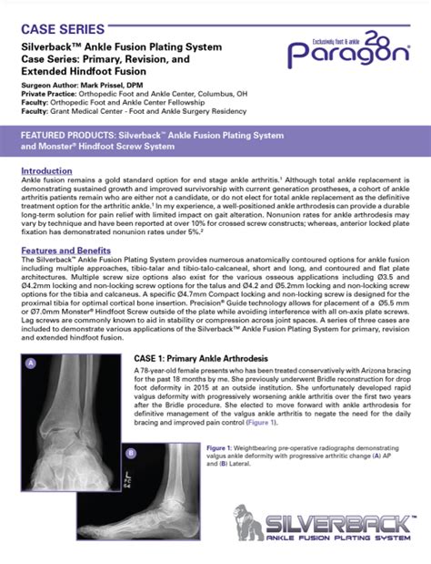 Silverback™ Ankle Fusion Plating System Paragon 28